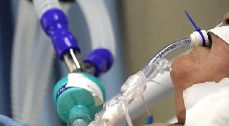 Recuerda doctor primer paciente COVID que intubó; pide evitar contagio