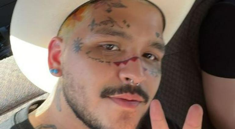 Video El Procedimiento Al Que Se Sometería Nodal Para Quitar Tatuajes